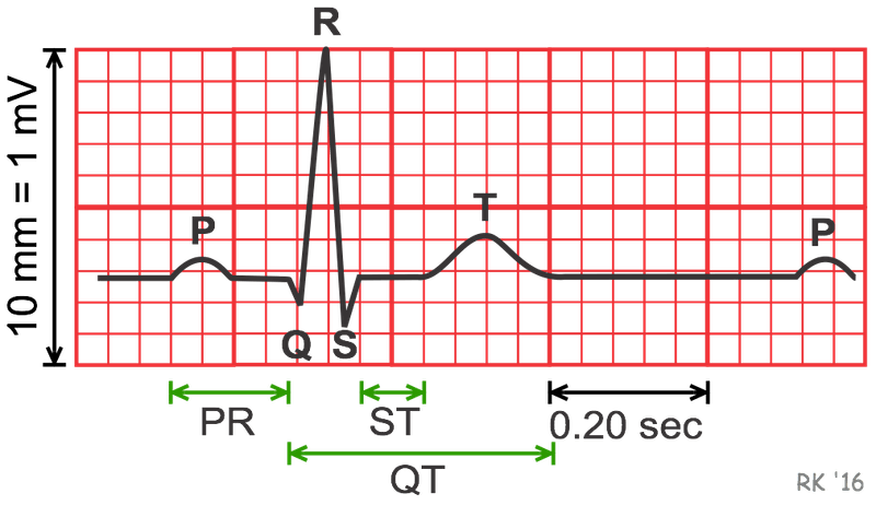 Cardio Calipers, On-Screen Electrocardiogram (EKG, ECG) Measurement