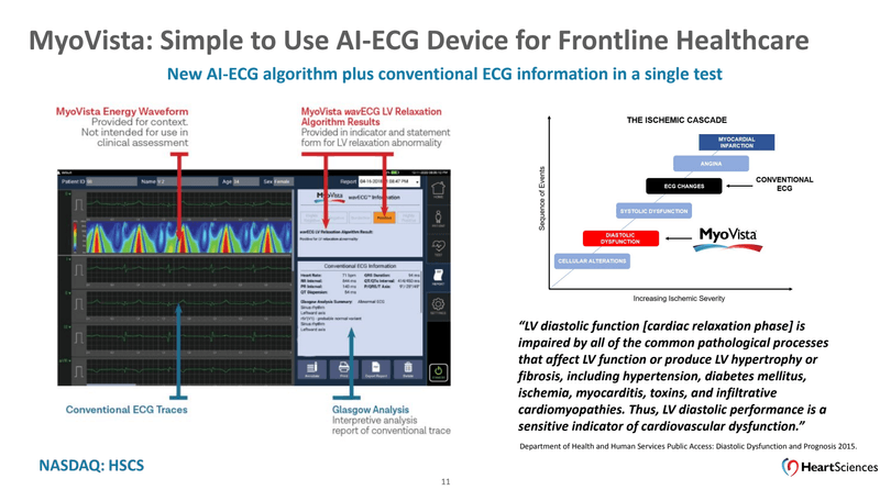 Invest in HeartSciences Stock | AI-Powered Heart Disease Detection