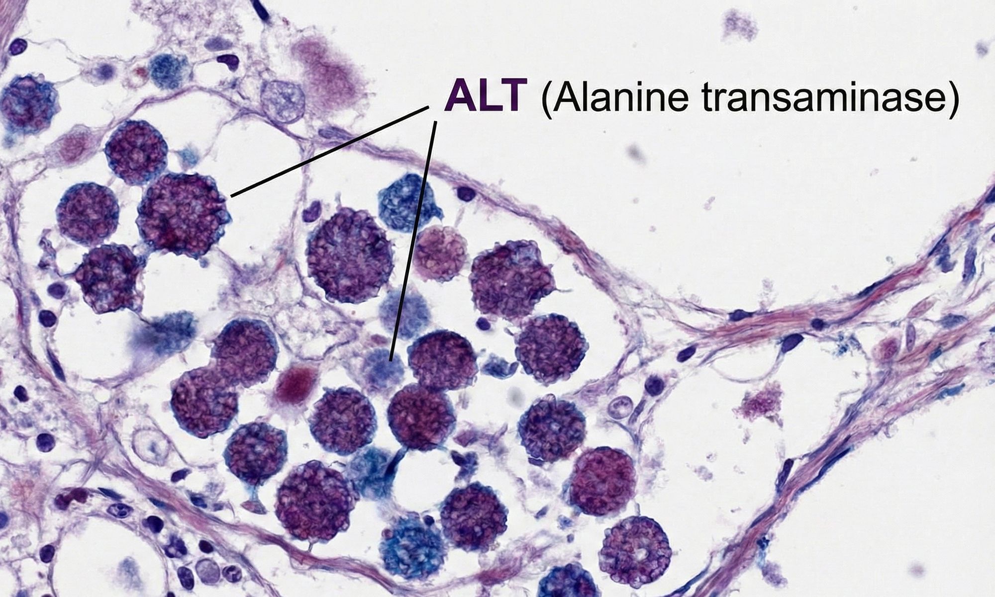 ALT Blood Test: High vs Low ALT Levels & At-Home Testing Guide | Choose ...
