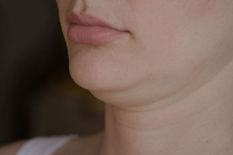 Profile Aesthetic Updates: Unveiling Emface Submentum: A New Era in ...