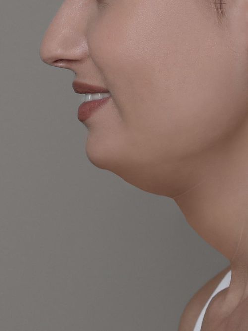 Profile Aesthetic is where innovation meets comprehensive care