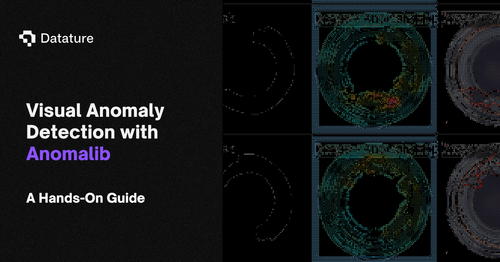 Visual Anomaly Detection with Anomalib: A Hands-On Guide [2026 ...