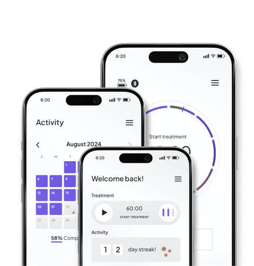 Dayspring Treatment for Lymphedema | Koya Medical