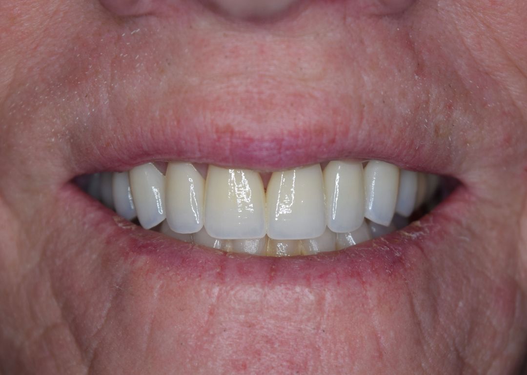 Advanced Dentistry of O'Fallon