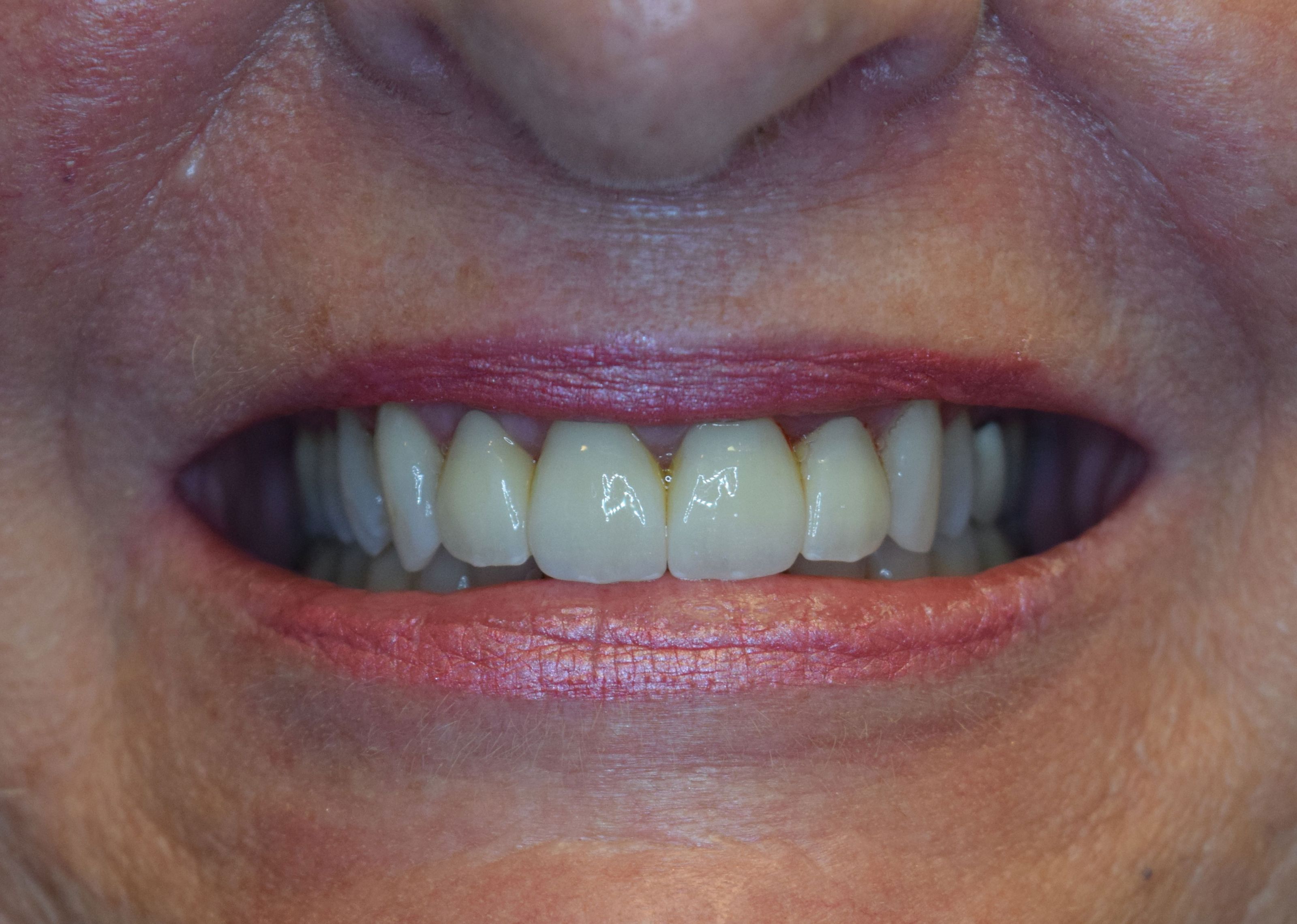 Advanced Dentistry of O'Fallon