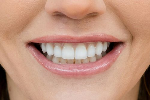 Blog | What Are Tooth Piercings and Are They Safe? | Espire Dental