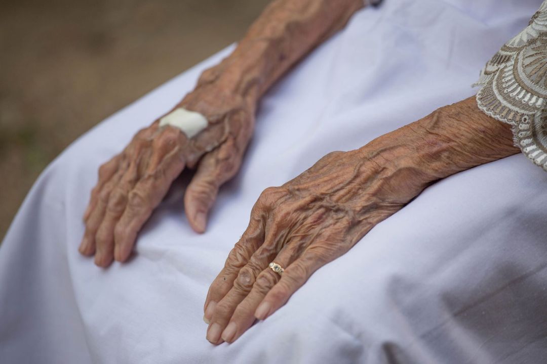 What is mottling of the skin? - LifeChoice