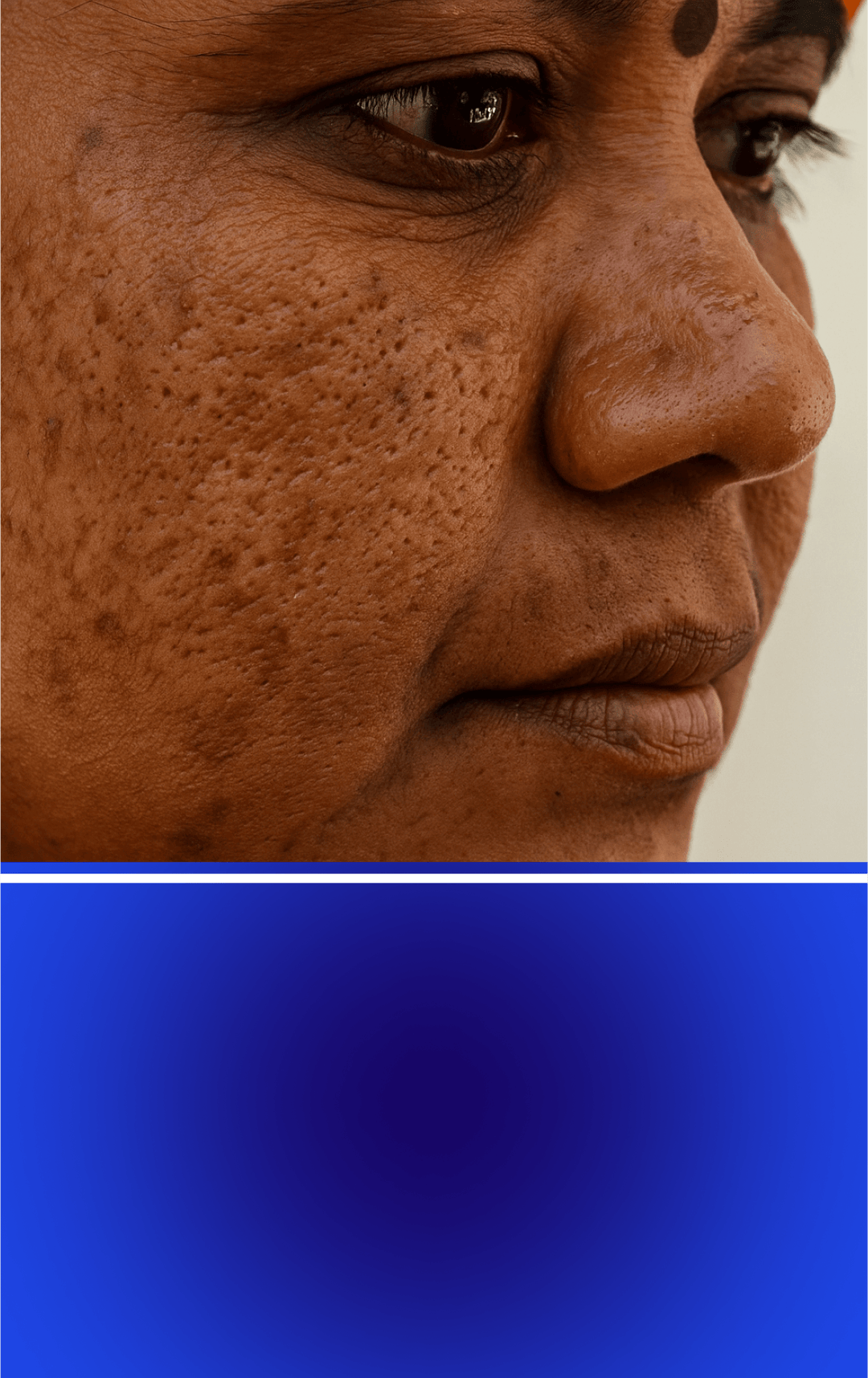 Lip Pigmentation: Causes and Treatments Explained