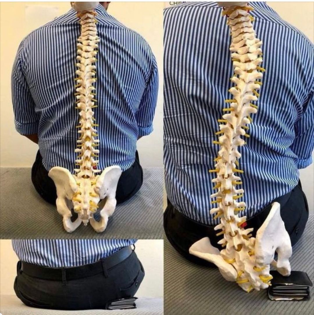 Wallet Sciatica: Back Pain from Sitting on a Wallet | Fix It Now