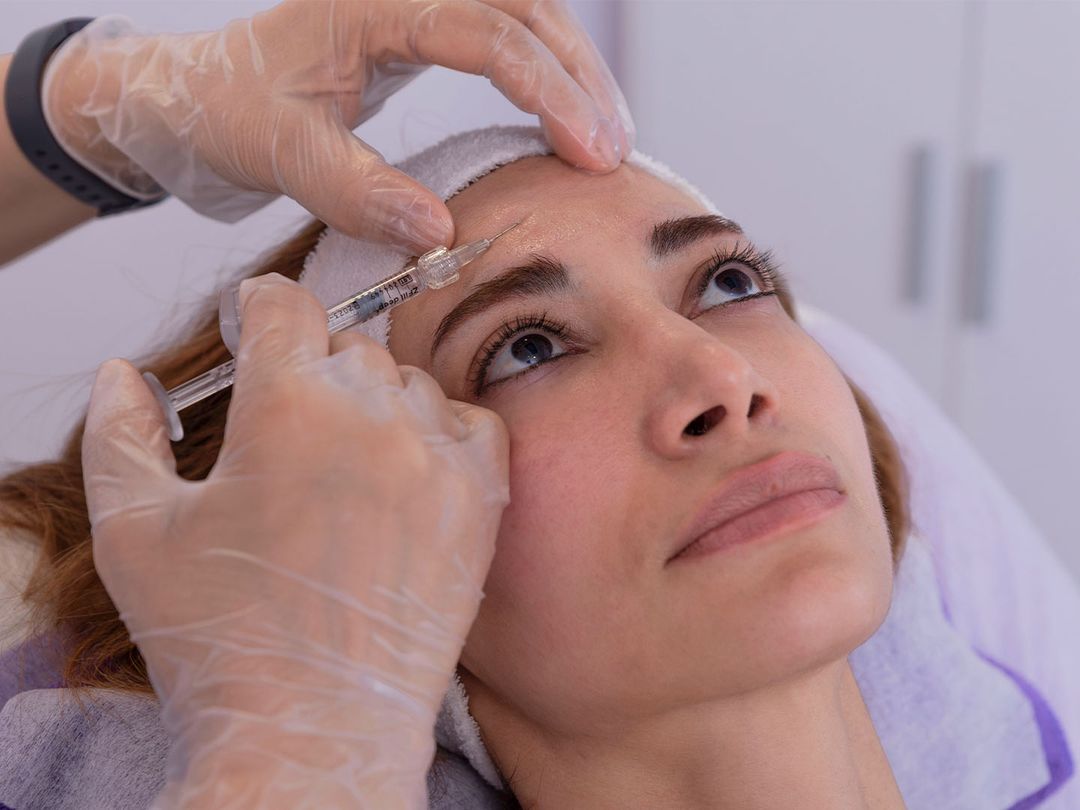 Cheek Filler Before and After: Real Results and Insights | Hubmed