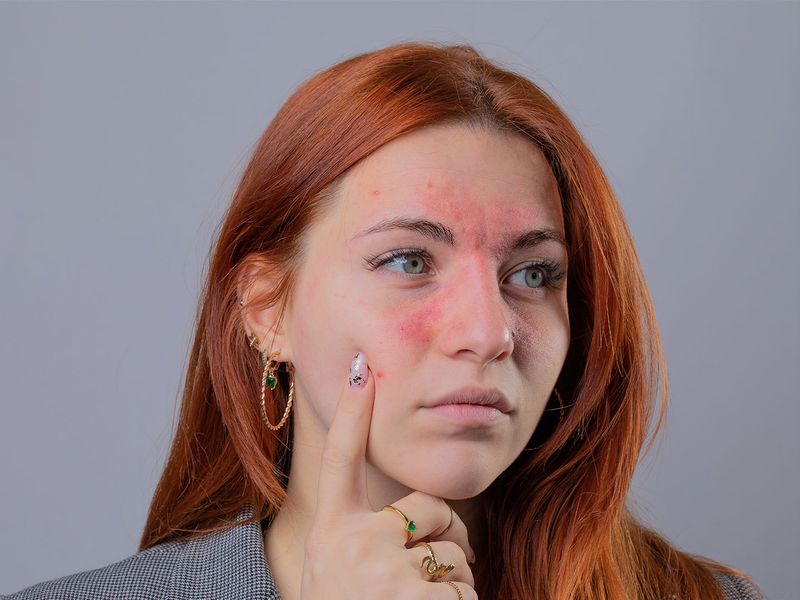 Spock Brow After Botox: Prevention & Fixes | Hubmed