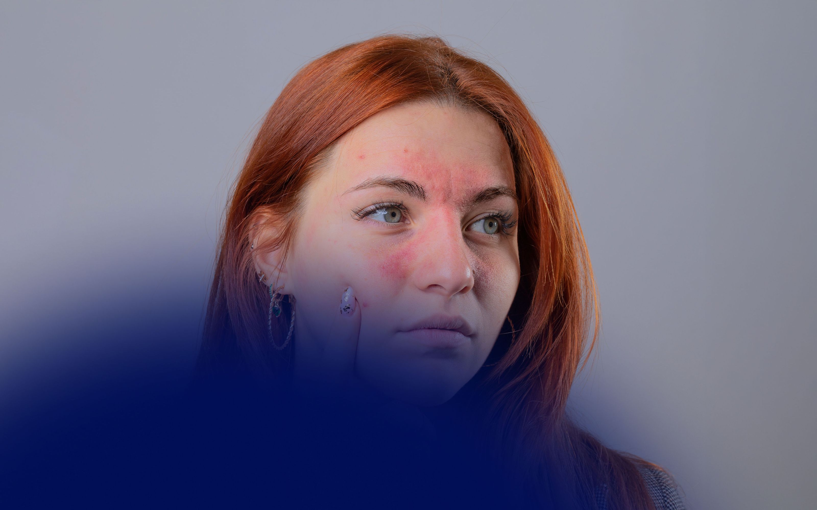 Botox Bruising Recovery and Prevention for Injectors at HubMed Ed | Hubmed