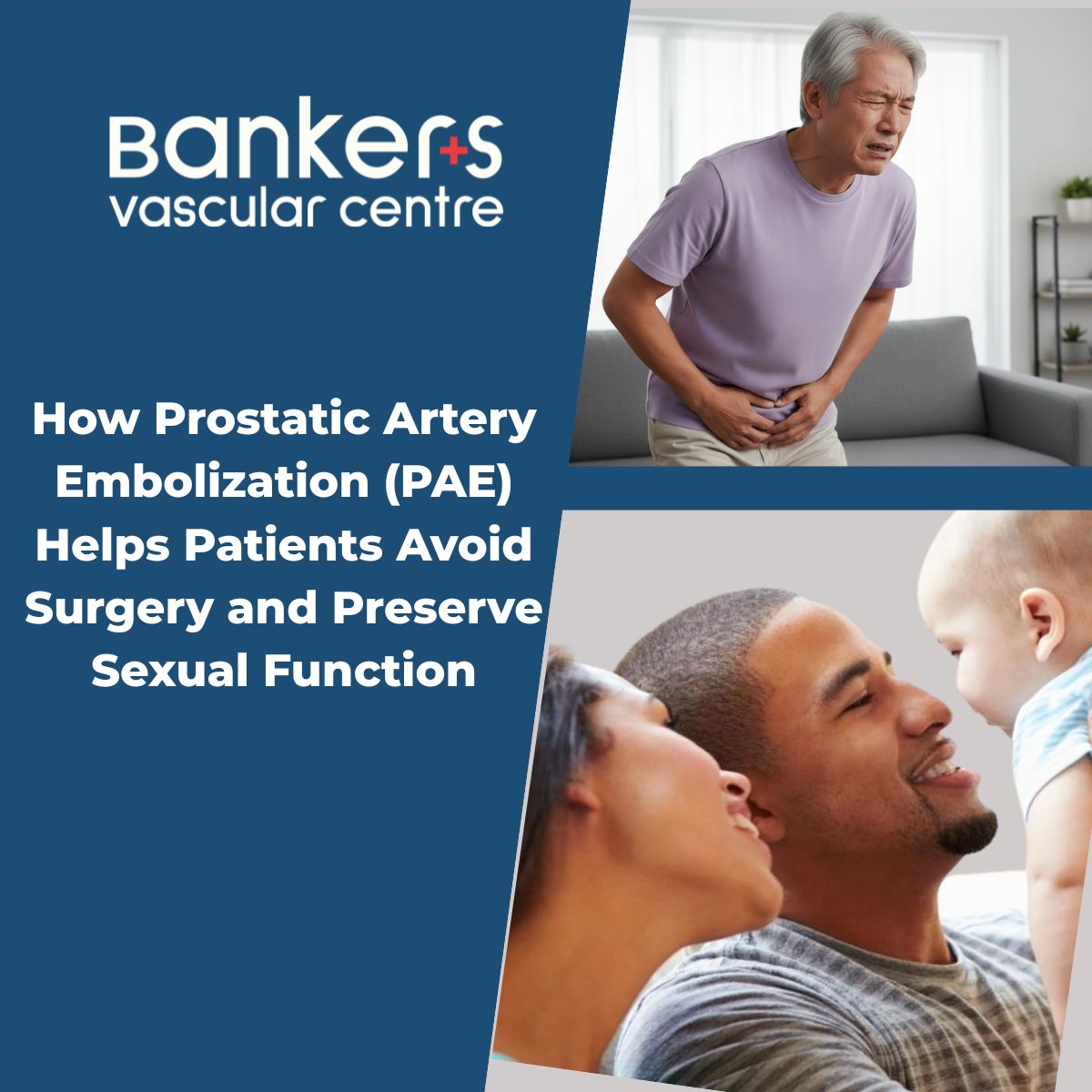 How Prostatic Artery Embolization (PAE) Helps Patients Avoid Surgery ...