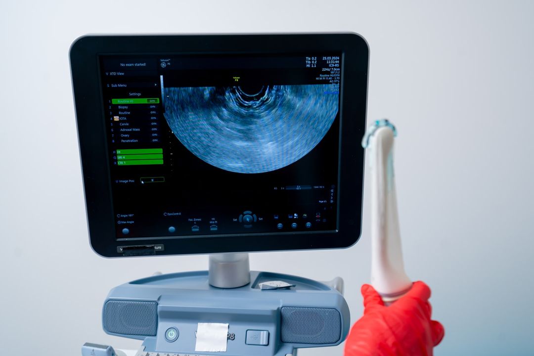 Ultrasonografie Generală | Ecografii Precise la CMIB