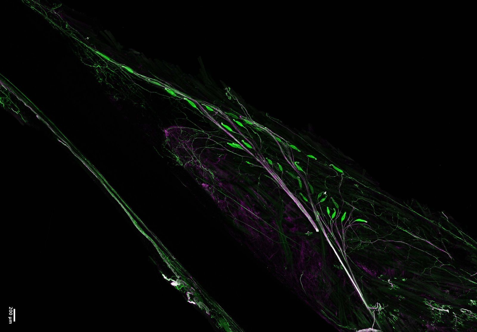 Familiar Objects Can Prevent Autism-like Behaviors in Mouse Model - Harvard Yang Tan Collective