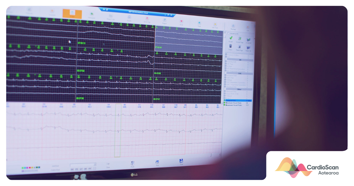 BeatBox | Flexible Cloud Technology for Cardiac, Respiratory or Sleep ...