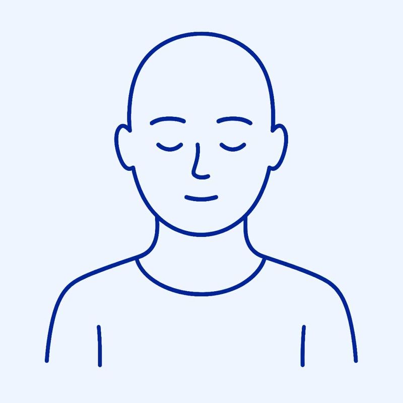 Alopecia Totalis – Causes and Treatment